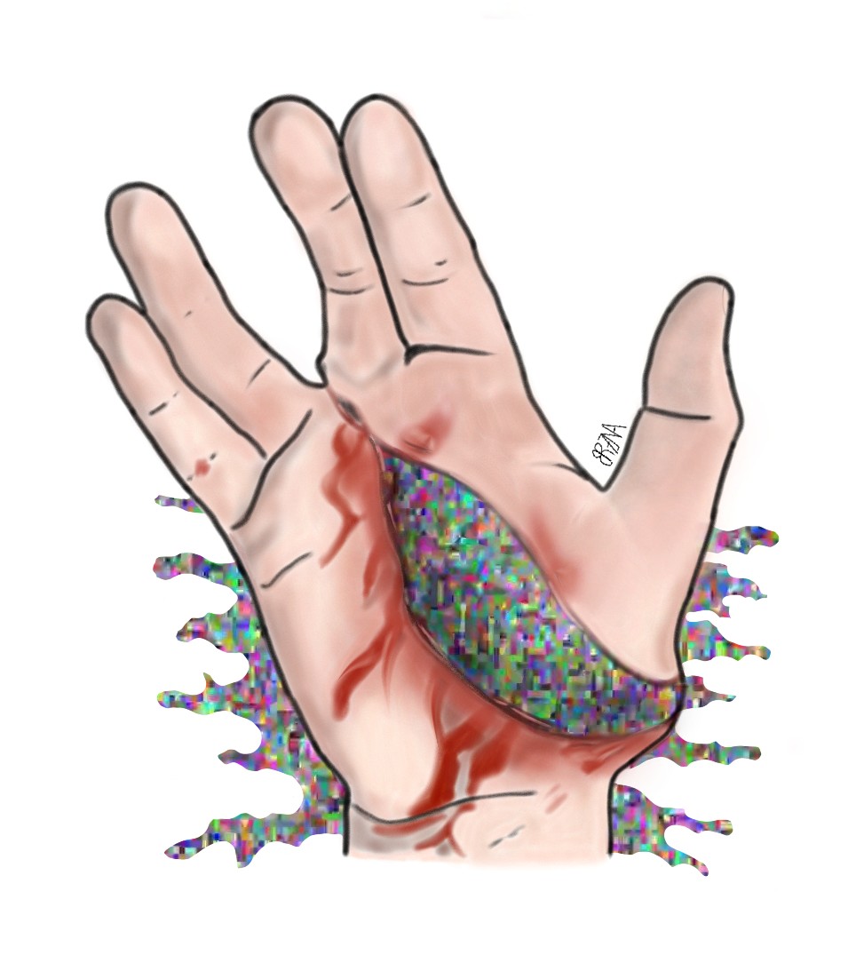 Static Hand ** TW: Blood